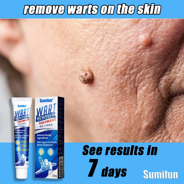 Sumifun Wart Removal Body Warts Treatment Cream Skin Tag Remover ...