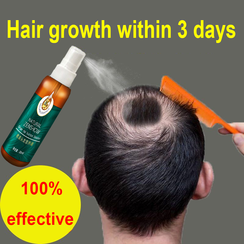 hair growth spray hair growth serum anti hair loss hair tonic ginger ...