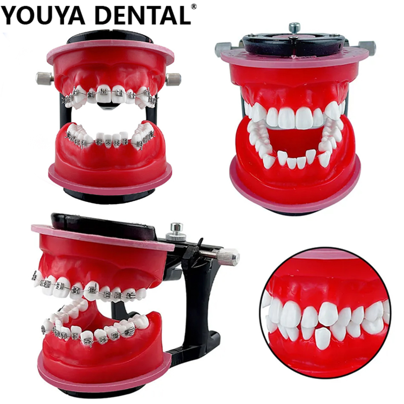 Dental Practice Teeth Model With Ortho Metal Brackets Orthodontic Model ...