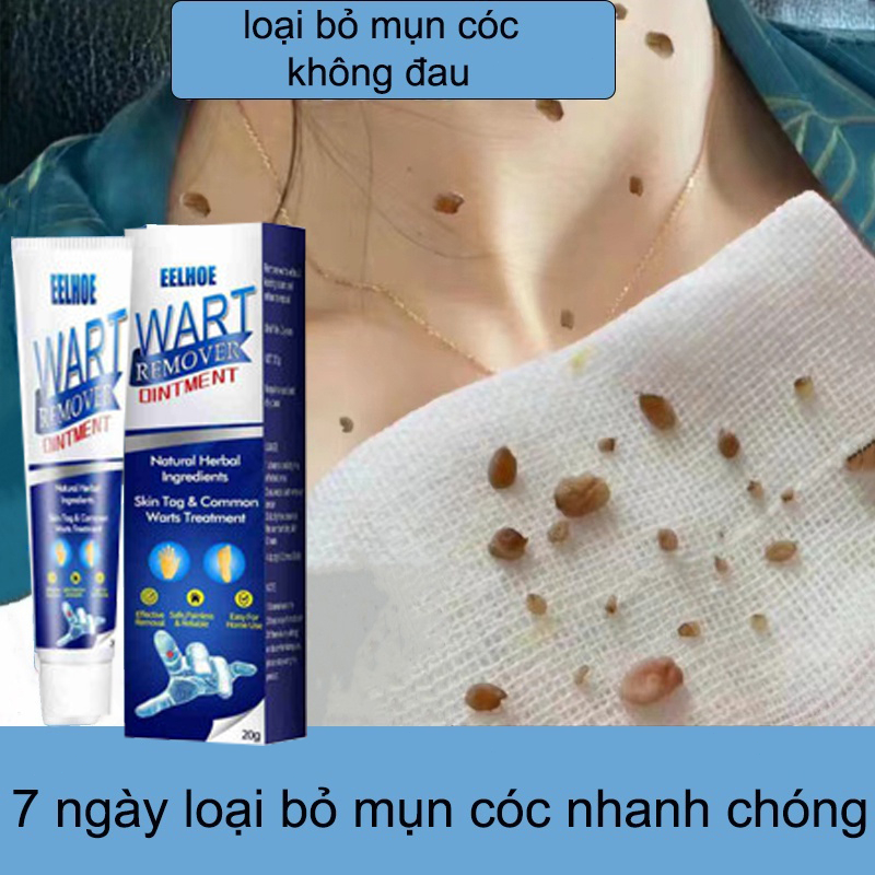 1pc 20g Sumifun Wart Removal Cream, Common Wart, Safe and Effective ...