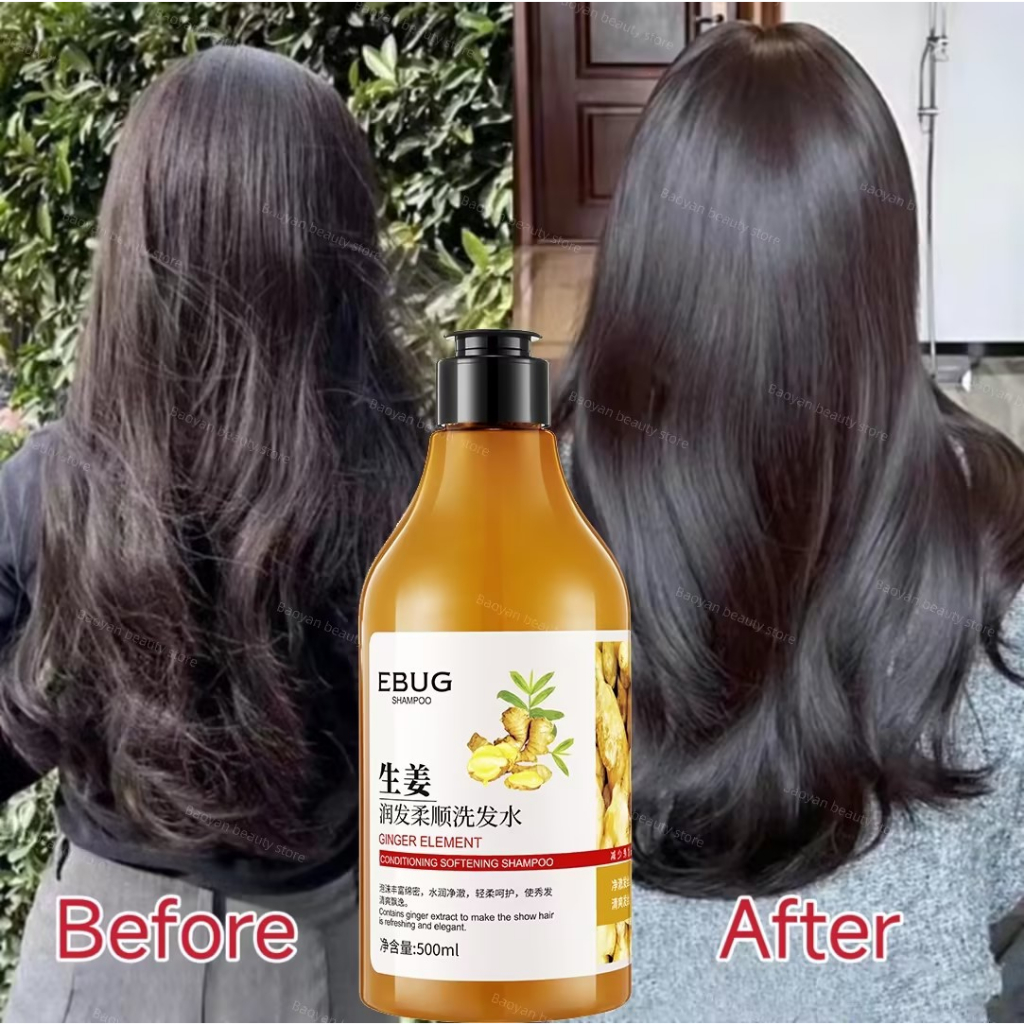 5pcs Loss Dandruff Scalp Treating the scalp Ginger shampoo for hair ...