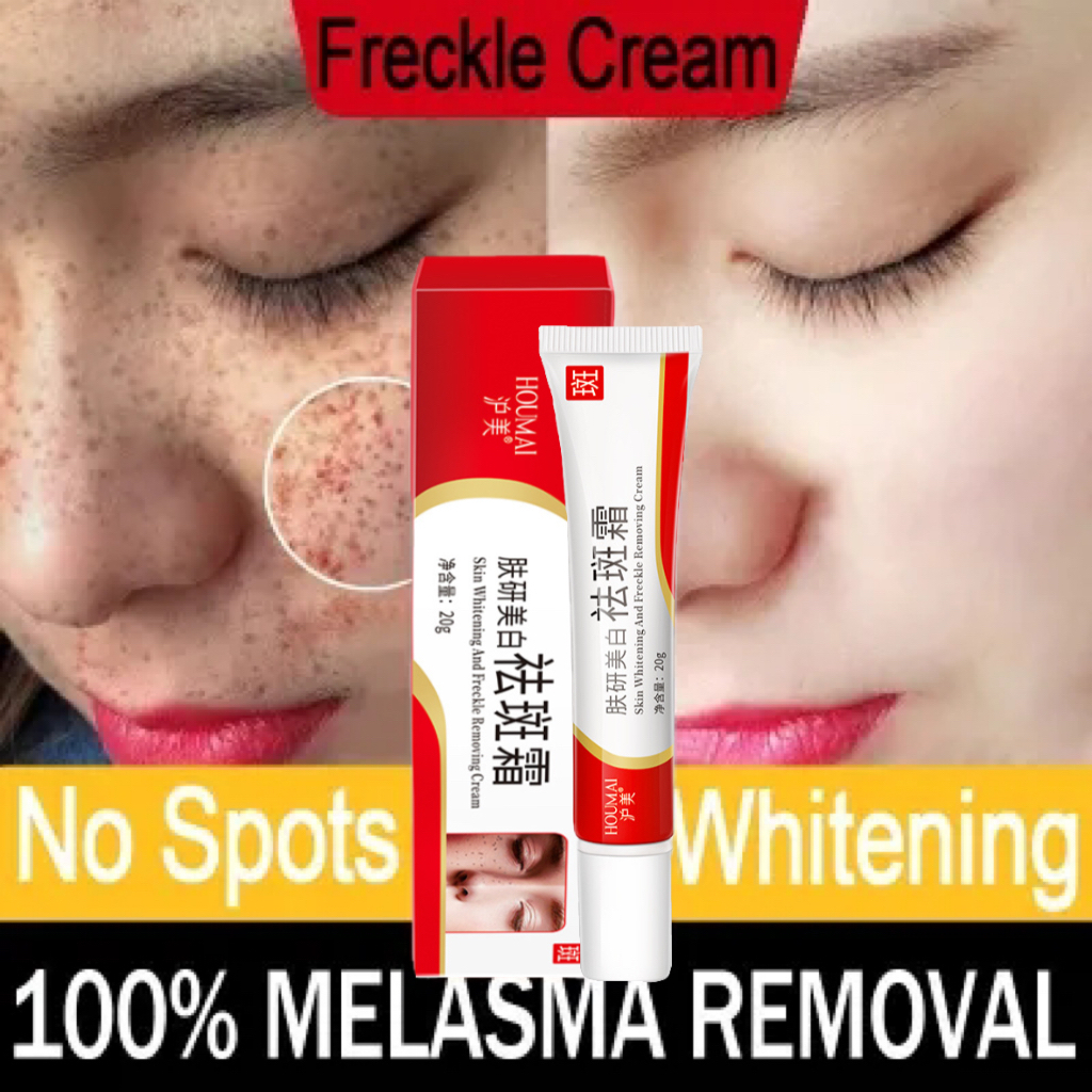 【buy 2 get 1 free】Effective Whitening Freckle Cream Remove Melasma Acne ...