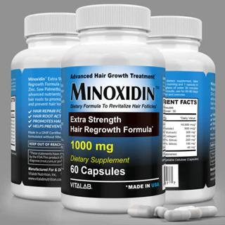 minoxidil hair treatment Malaysia, Best Deals December 2025 | Shopee ...