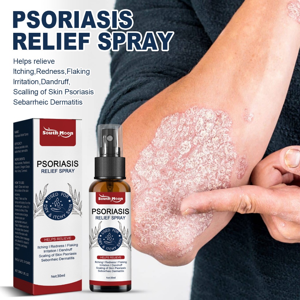 Psoriasis relief spray 30ml Scalp, hands, feet, Eczema, Fungus, Anti ...
