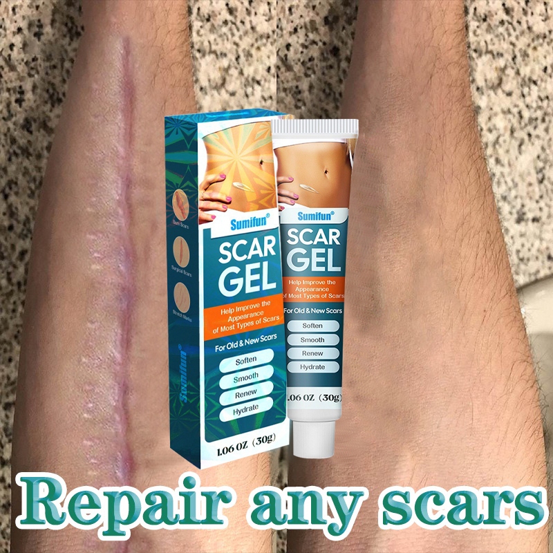 Scar Removal Cream Scar Repair Gel Stretch Mark Cream 30g 护创修疤凝胶 ...