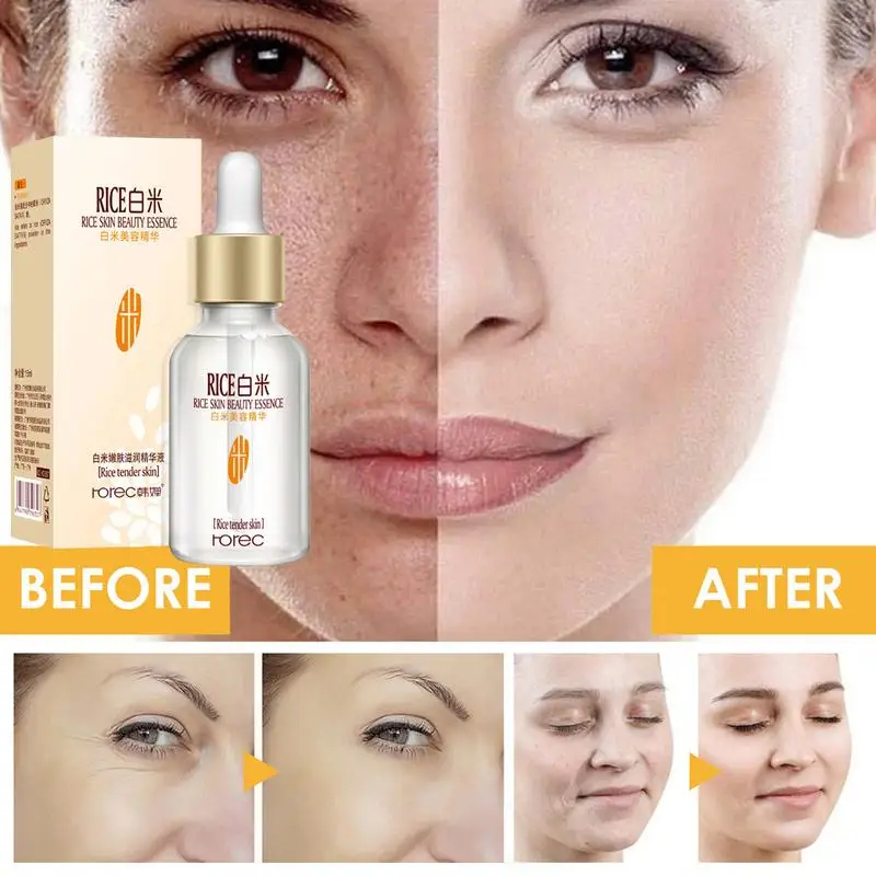 White Rice Serum Original Whitening Face Moisturizing Cream Anti