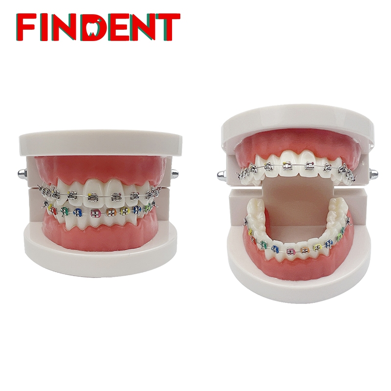 Dental Typodont Orthodontic Model Half Self Ligating Normal Metal ... Dental Typodont Orthodontic Model Half Self Ligating Normal Metal ...