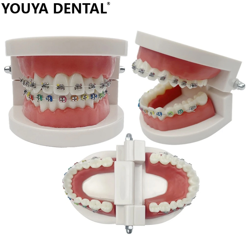 Dental Typodont Orthodontic Model Half Self Ligating Normal Metal ... Dental Typodont Orthodontic Model Half Self Ligating Normal Metal ...