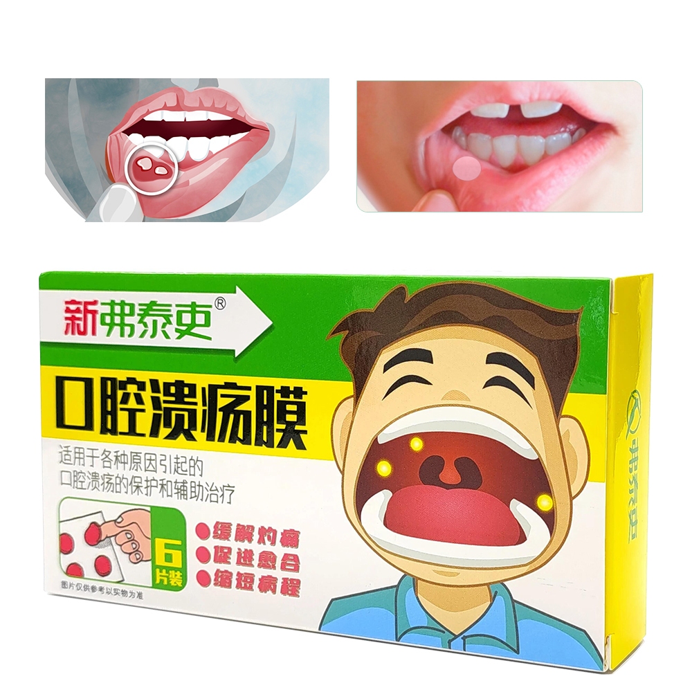 Oral Ulcers Patch 12pcs/2boxes Relief Severe Pain Irritation Canker ...