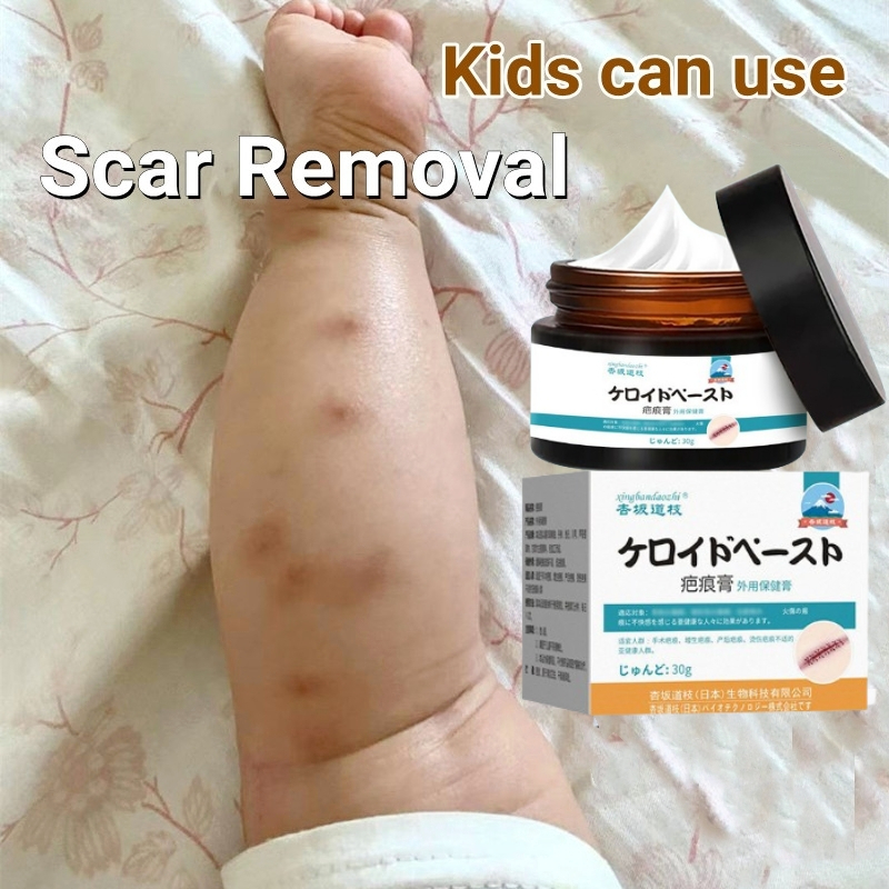 Scar Repair Cream krim parut hilangkan parut bayi krim parut kaki ...