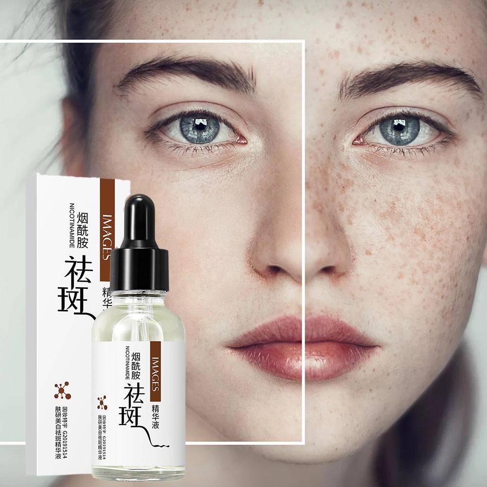 Whitening Freckle Niacinamide Serum Jeragat Remove Melasma Dark Spots Melanin Melasma ...