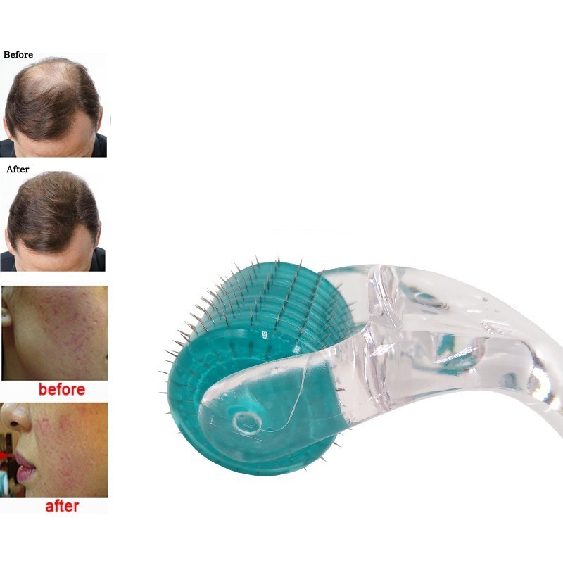 192 Micro Needle Derma Roller Therapy Transparent handle Microneedling ...