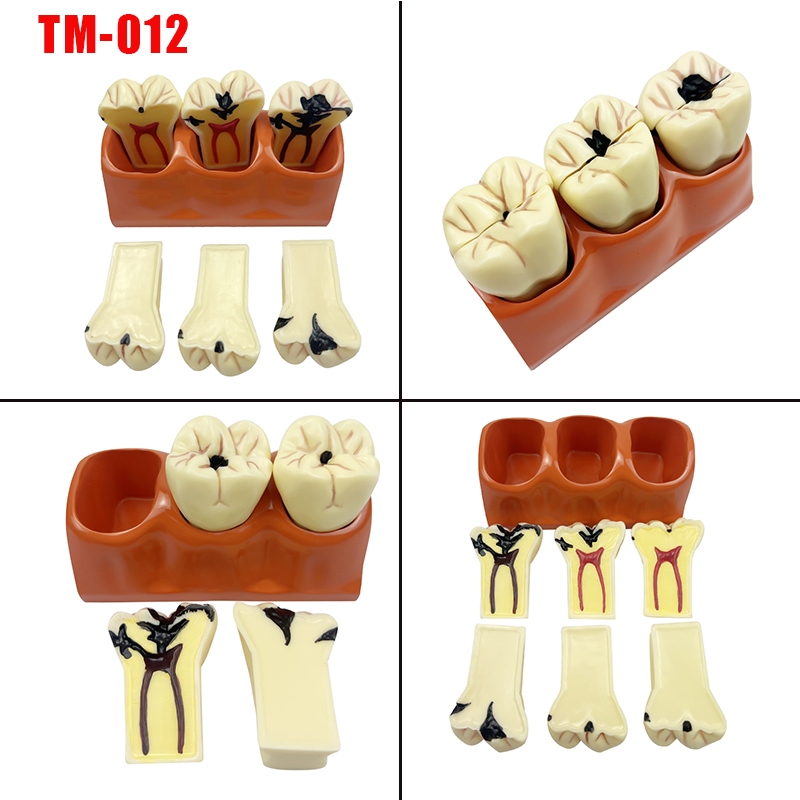 Multiple Types Dental Teeth Model Teaching Models Typodont Orthodontic ...