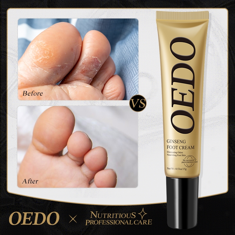 OEDO Ginseng Nail Antifungal Treatments Cream (15g) | Shopee Malaysia