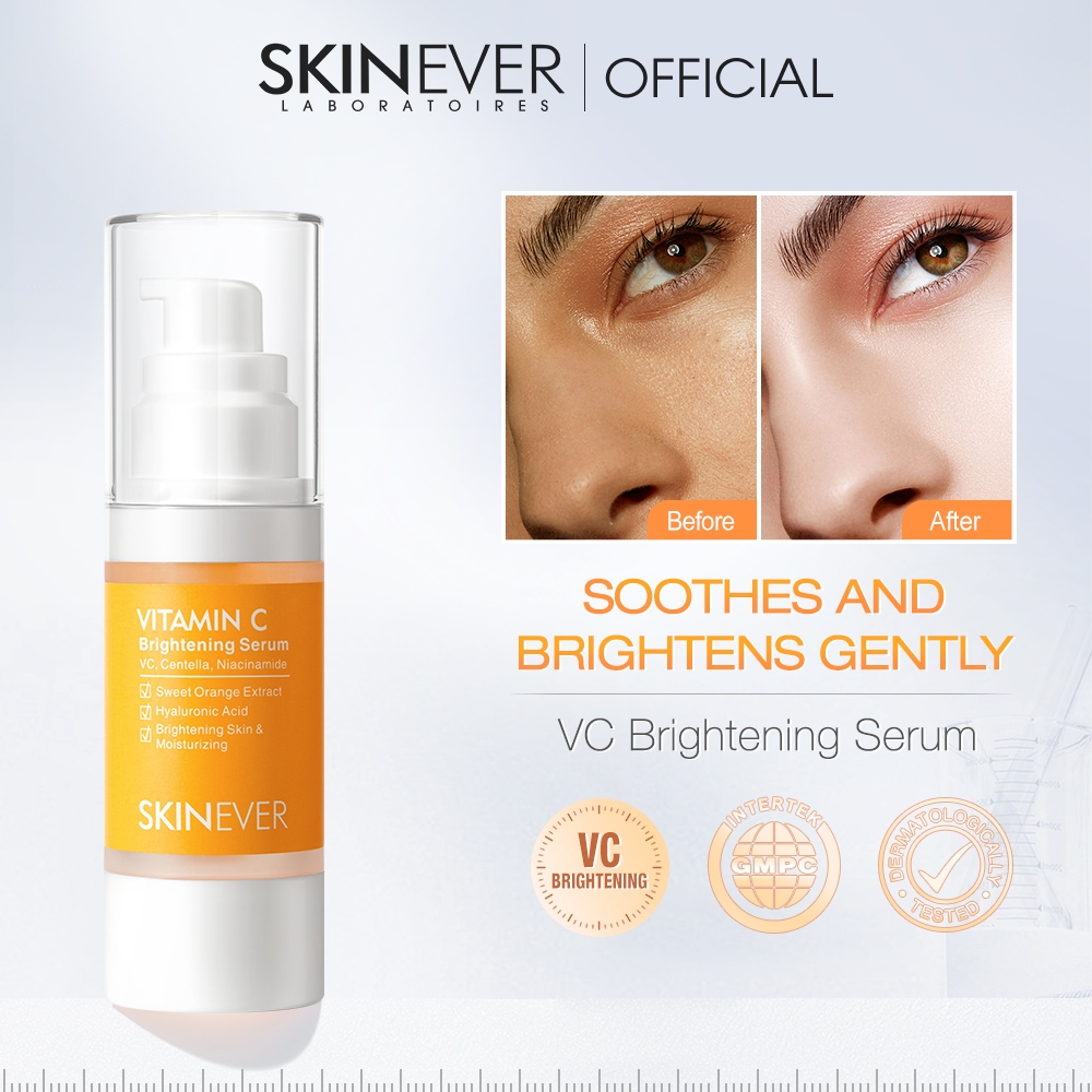 SKINEVER vitamin C Whitening and moisturizing, brightening and ...