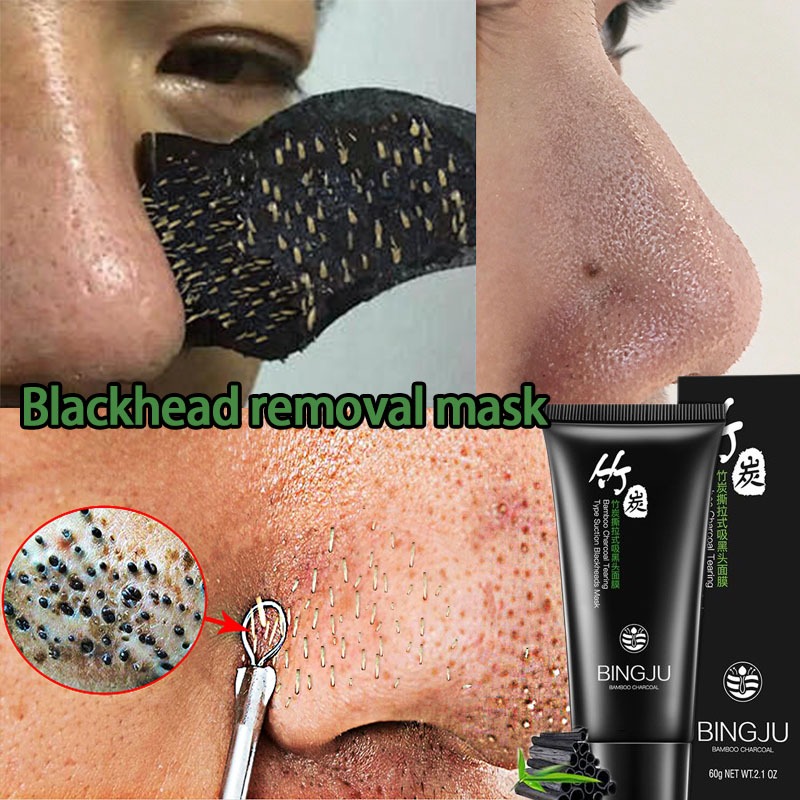 whitehead remover blackhead remover masker blackhead 60g peel off mask ...