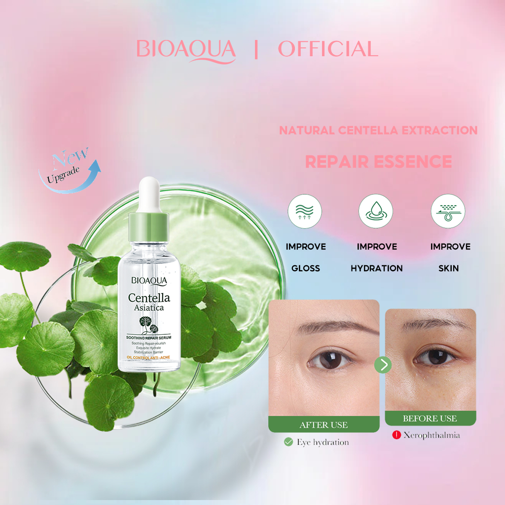 BIOAOUA Centella Asiatica Soothing Repair Serum 积雪草修复精华 | Shopee Malaysia