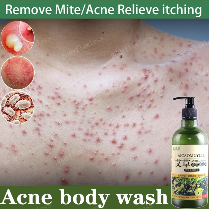 Acne body wash-Eczema body wash- 艾草沐浴露 500ml Solve Itching ...