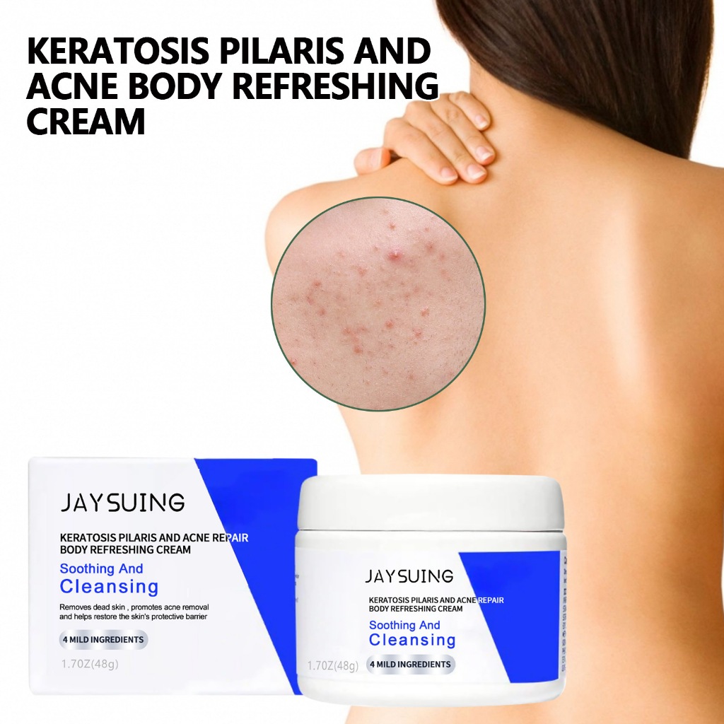 Jaysuing Keratosis Pilaris And Acne Body Refreshing Cream Back Acne