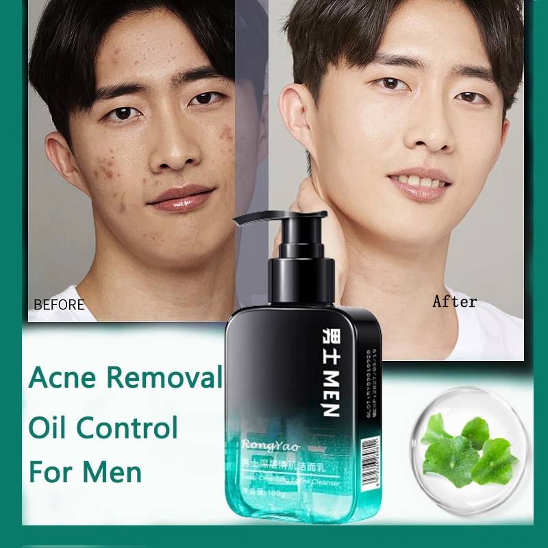 HB Jerawat Pencuci Muka Lelaki Anti-Acne Facial Cleanser Remove Mite ...