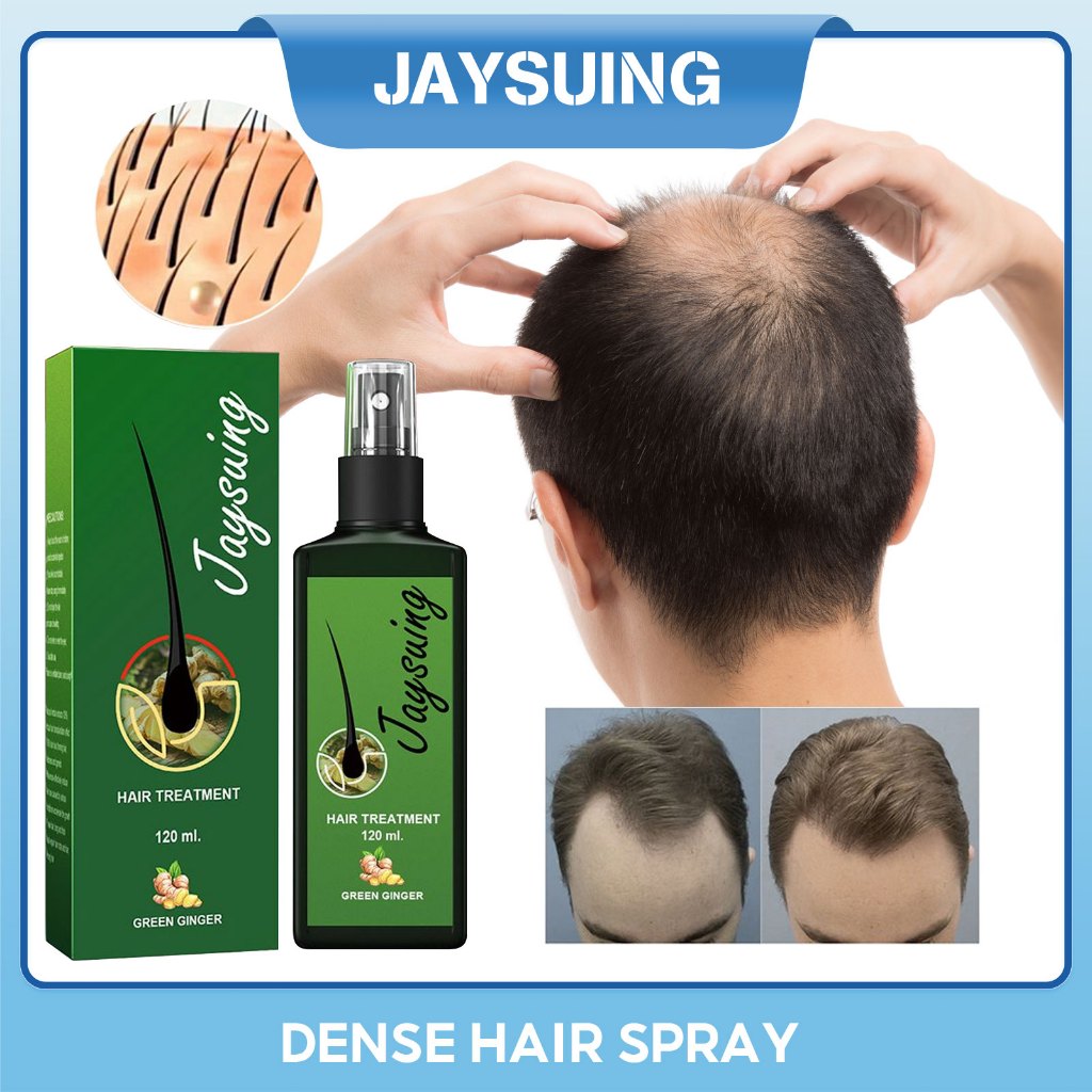 [24h]Jaysuing Ginger Hair Treatment Growth Supplies Ubat Rambut Botak ...