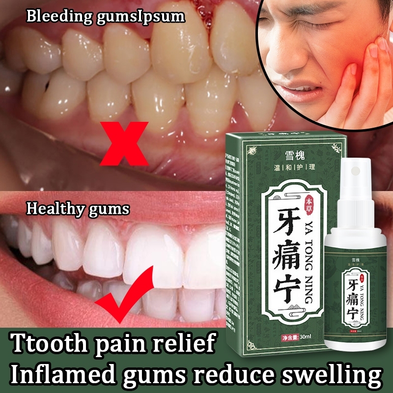 Toothache Pain Relief Oral Spray Tooth Pain Relief Spray 30ml Healthy ...