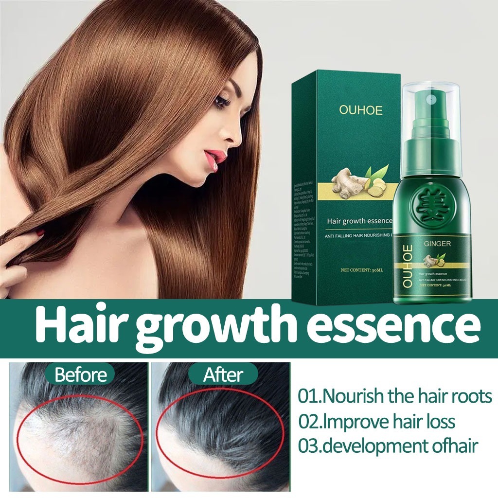 Ouhoe 30ml Hair Growth Spray Serum Anti Hair Loss Products Fast Grow
