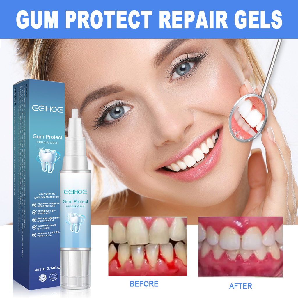 Gum Protect Repair Gel 4ml Gums Therapy Inflammation Receding Treatment ...