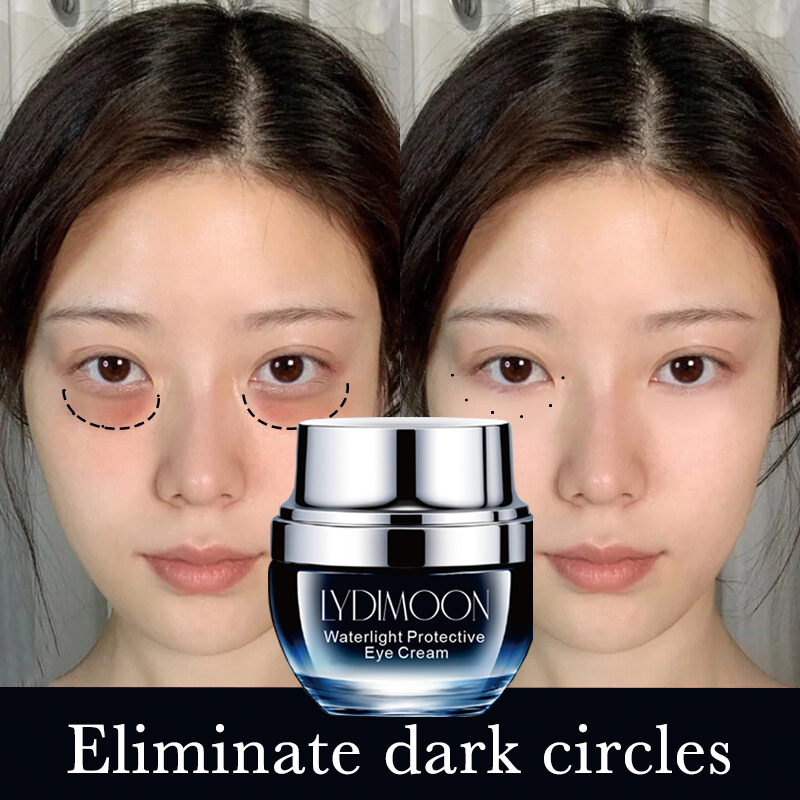Eye cream dark circles eye bag removal 30g remove puffy eye fat granule ...