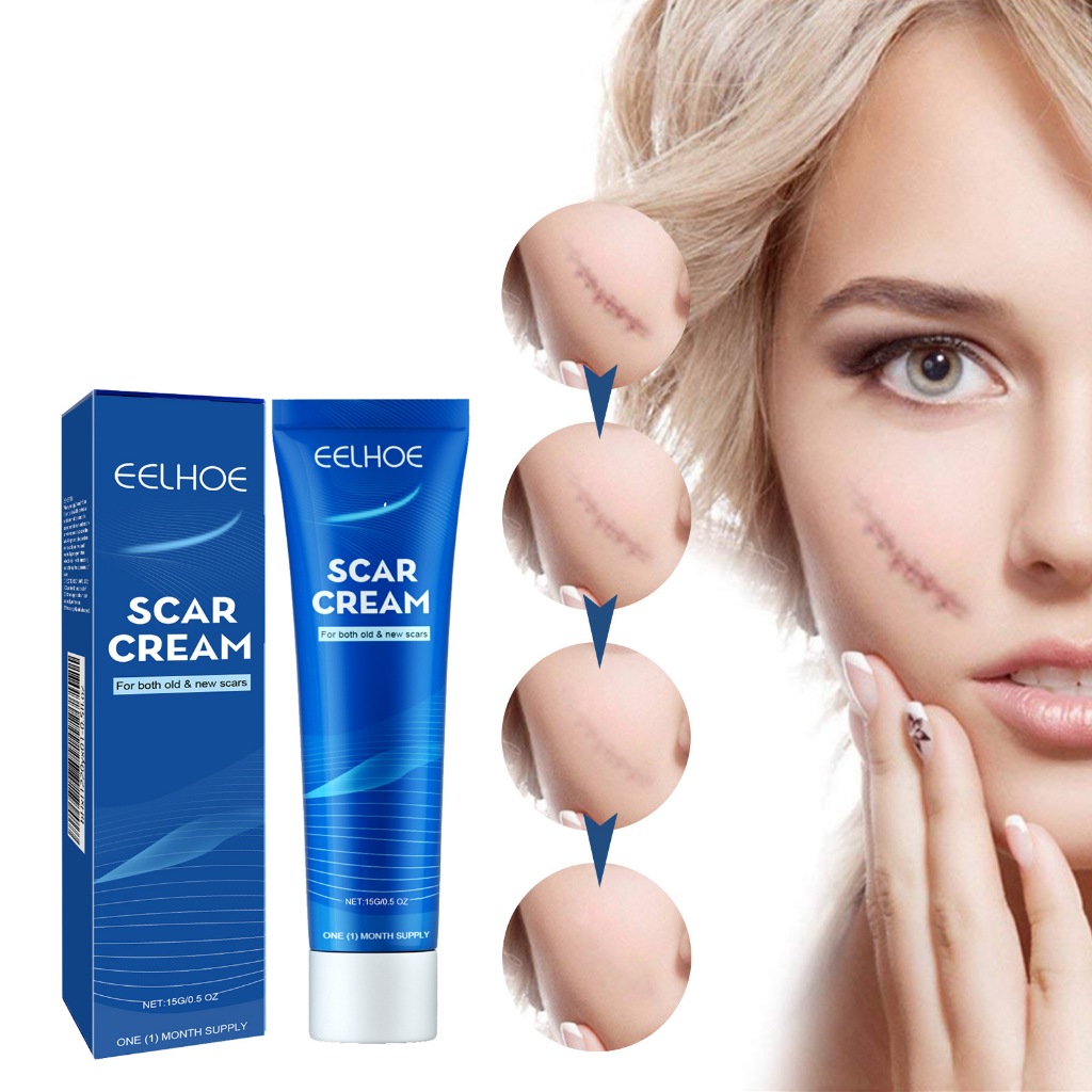 eelhoe skin repair cream scar cream care burn burn marks acne marks ...