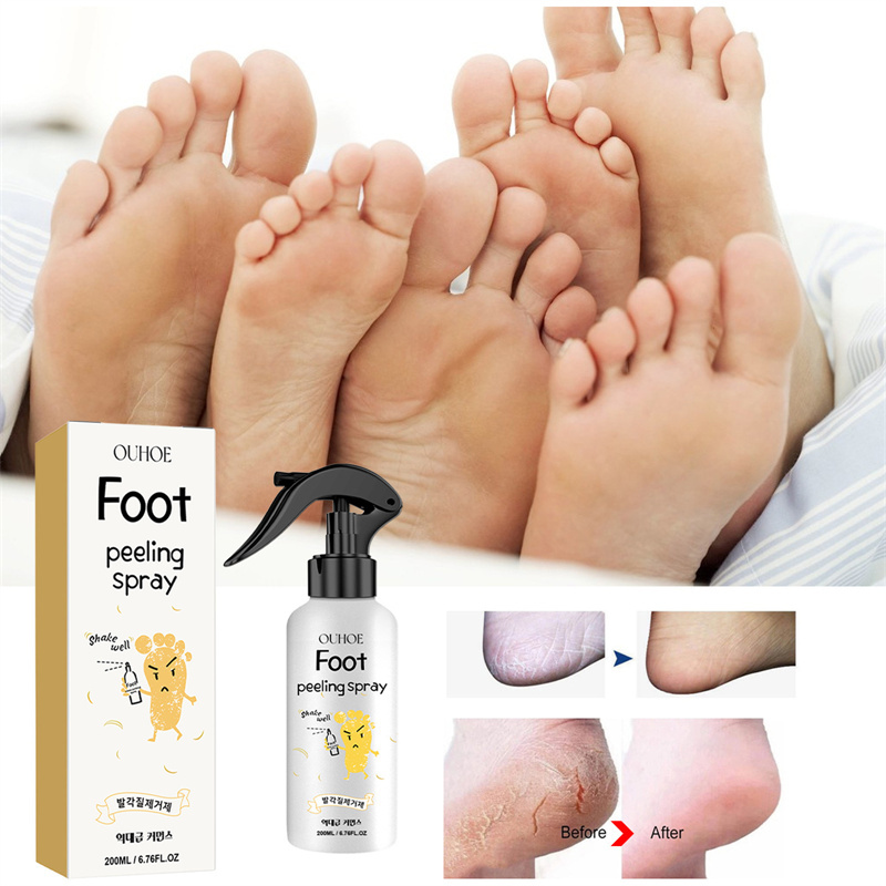 200ml Foot Peeling Spray Foot Exfoliation Spray Pedicure Dead Skin ...