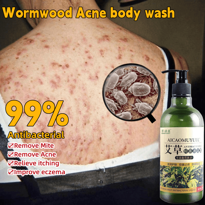 body wash - acne - eczema body wash 500ml 艾草沐浴露 Strong antibacterial Remove mite Acne Relieve ...