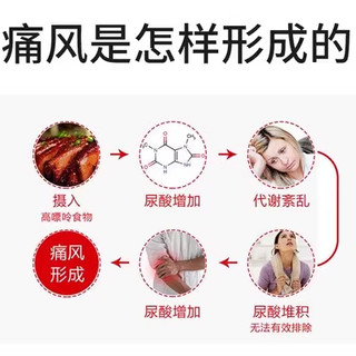 Official genuine gout medical cold compress gel gout joint stiff numb ...