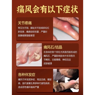 Official genuine gout medical cold compress gel gout joint stiff numb ...