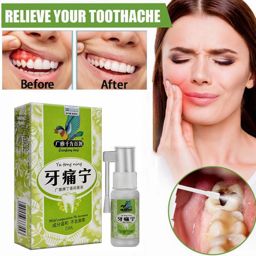 Toothache Treatment Spray Relieves Periodontitis Tooth Decay Pains ...