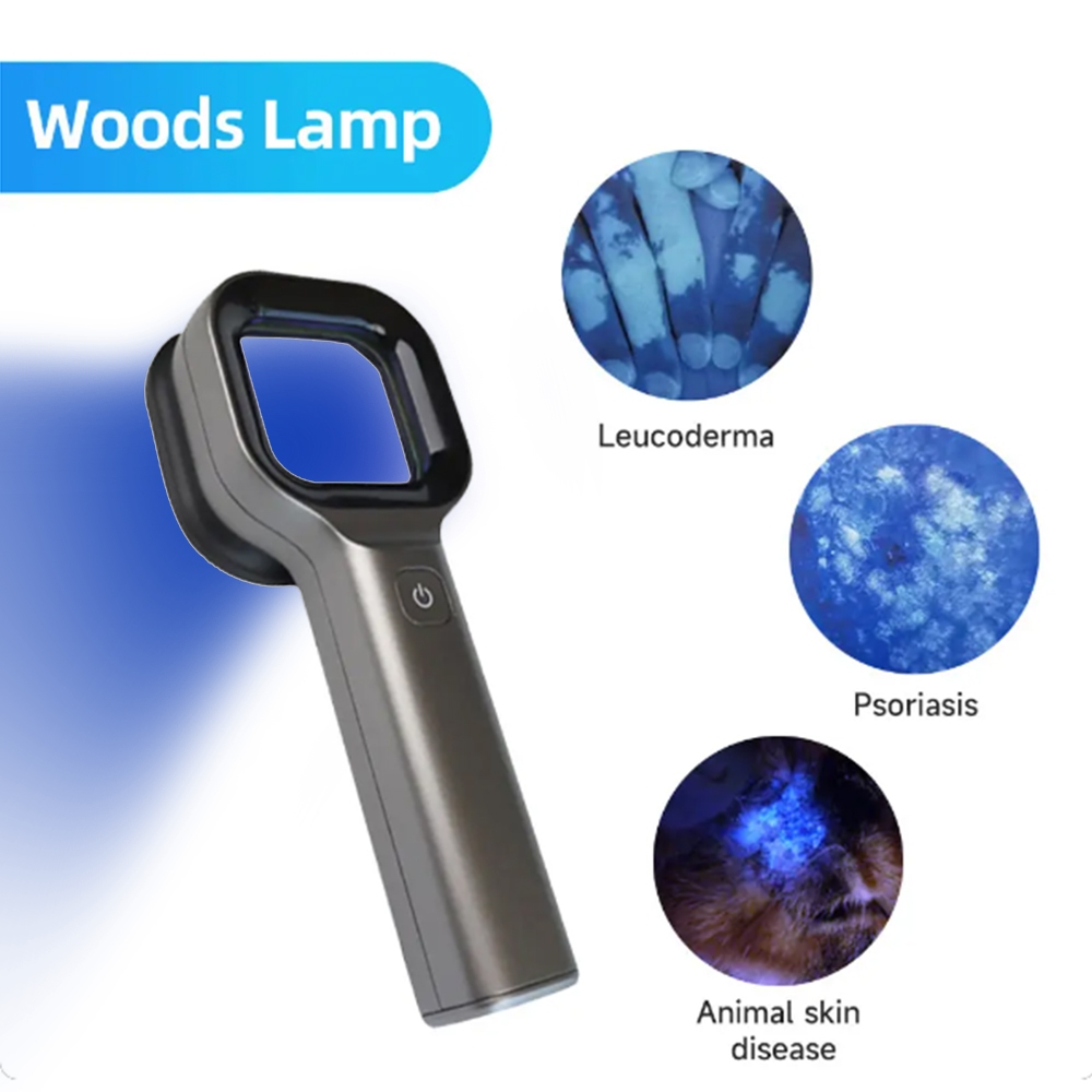 Yongrow Medical Woods Lamp Skin Examination Skin Fungus Detector Vitiligo Pityriasis Versicolor ...