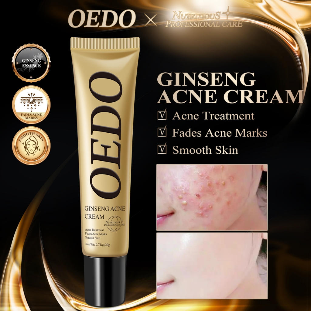 OEDO Plant Extraction Repair Acne Cream Lighten Acne Marks Oil Control ...