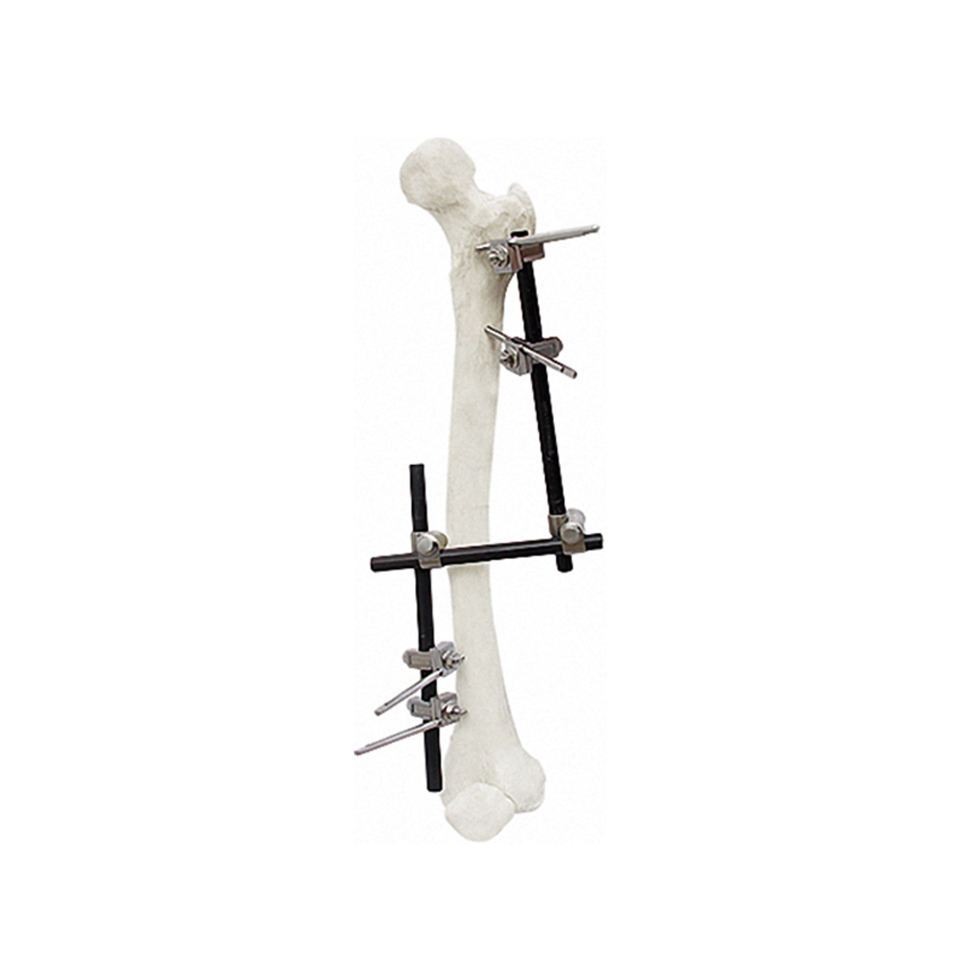Professional External Fixation Frame SS Titanium Peek Orthopedic AO ...