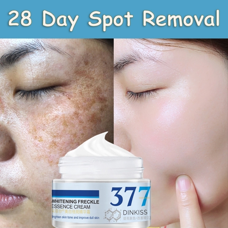 Dark spot remover Freckles removal cream Pigmentation remove cream 50g ...