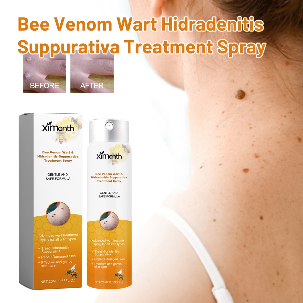 Bee Venom Wart & Hidradenitis SuppurativaTreatment Spray Tag Treatment ...