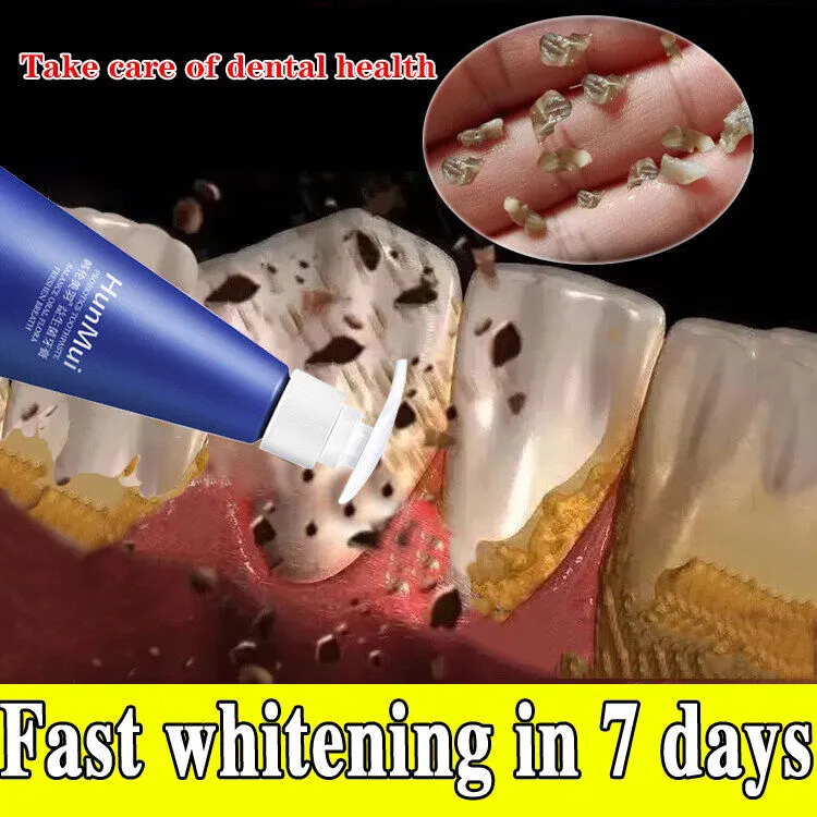 290g Removes tartar Whitening toothpaste Probiotic toothpaste ...