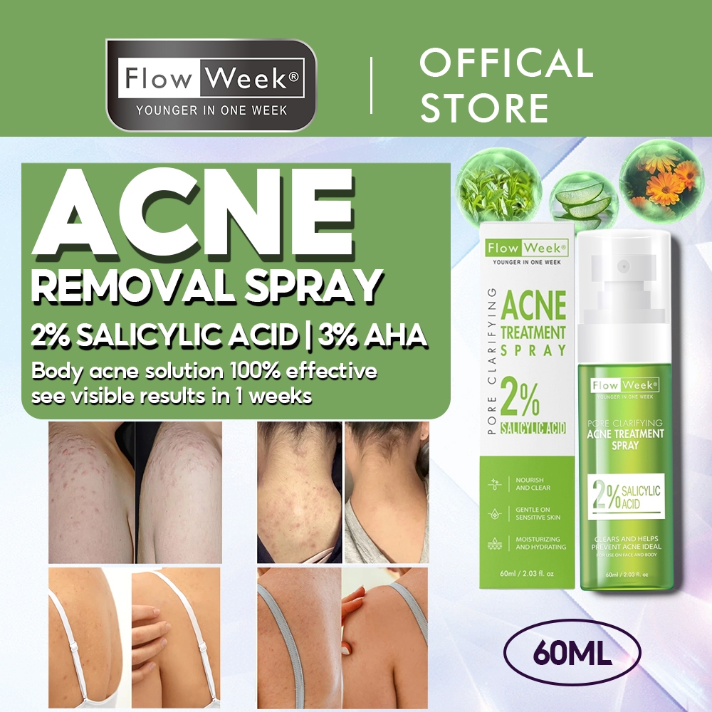 FlowWeek Body Acne Spray Salicylic Acid Pimple Remover Acne Solutions ...