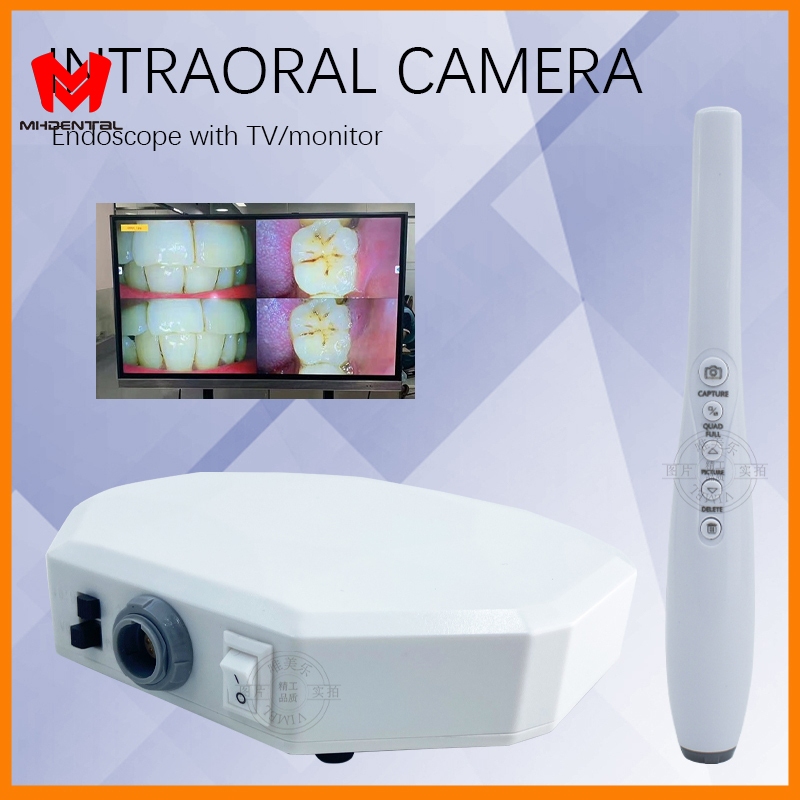 Intraoral Camera System Oral Dental Endoscope Portable SONY CMOS WifI ...