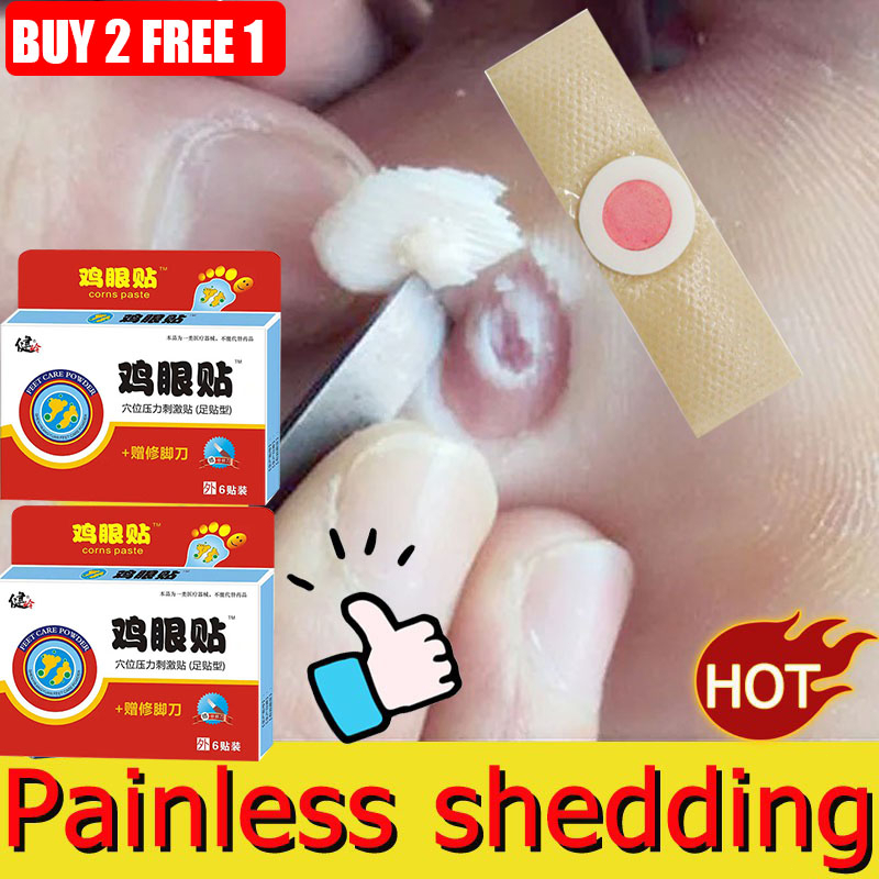 penampal ketuat ubat ketuat Wart Remover Pads Corn Remover 鸡眼贴 6 pcs ...