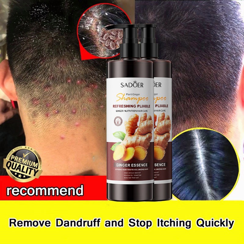 Ginger shampoo500ml Soriasis shampoo Farewell scab scalp Anti-hair loss ...