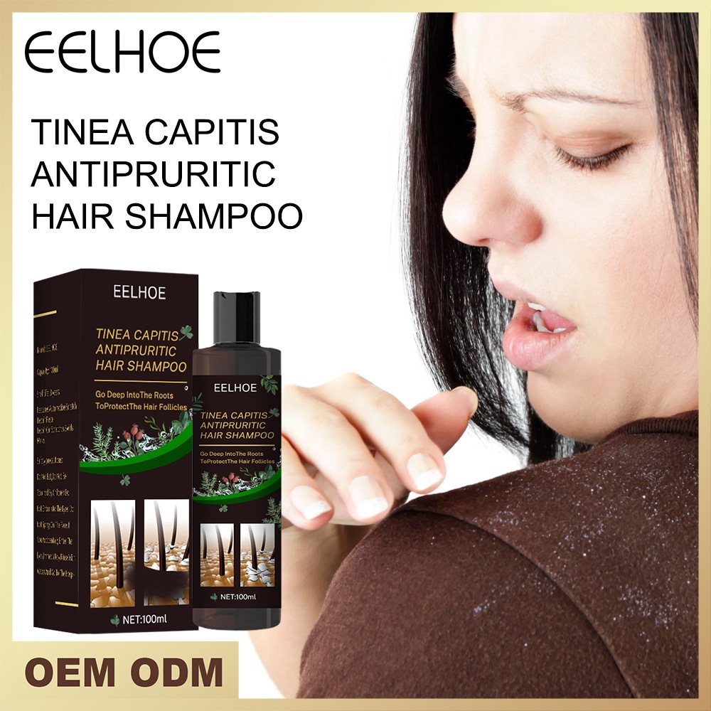 Air Shampoo for Tinea Capitis Antipuritic Professional Antidandruff ...