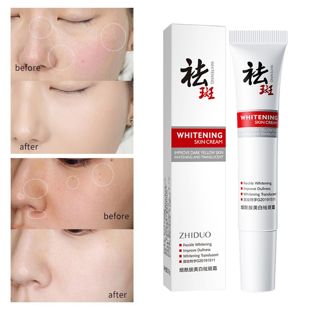 Dark Spot Corrector Cream Whitening Freckle Cream Powerful Removing Melasma Melanin Dark Spots ...