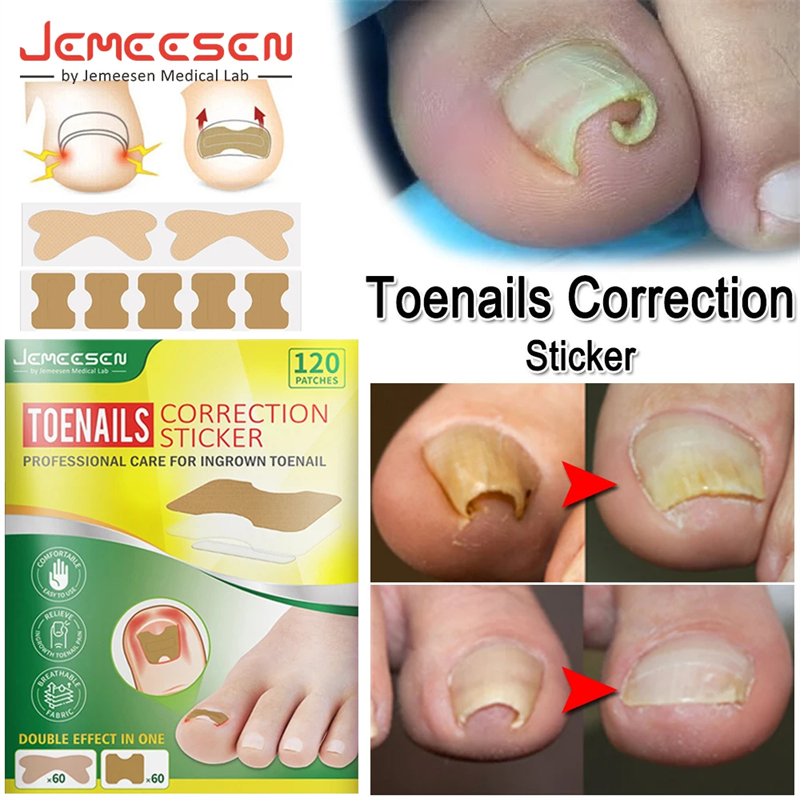 Jemeesen 120 pieces of paronychia removal patches, nail fungus ...