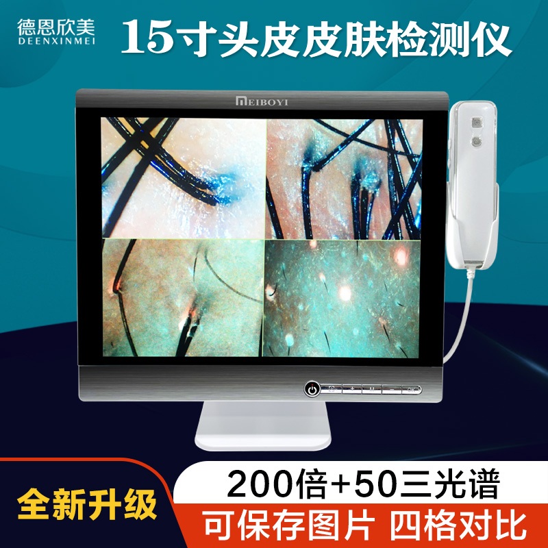 50cm Screened Scalp Detector Hair Follicle Hair Testing Instrument HD ...