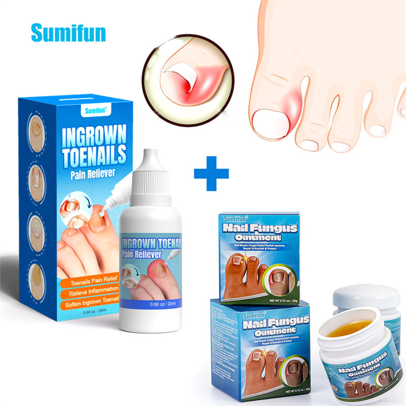 Nail Fungus Ointment Ingrown Toenails Pain Reliever Feet Nails Repair ...